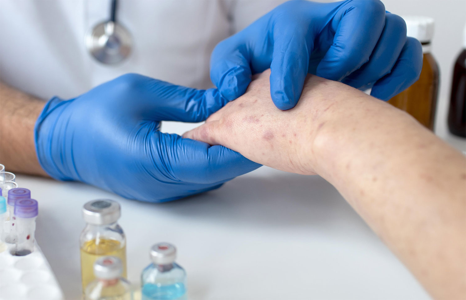 Infezione: significato e sintomi - Stimola Collagene
